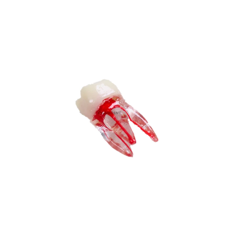Dental-Typodont-Tooth-Endo-Root-Canal-Study-Model-For-RCT-Practice ...