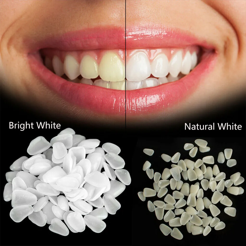 50 Pcs/Kit Dental Anterior Teeth Molar Porcelain Veneer Dentistry ...