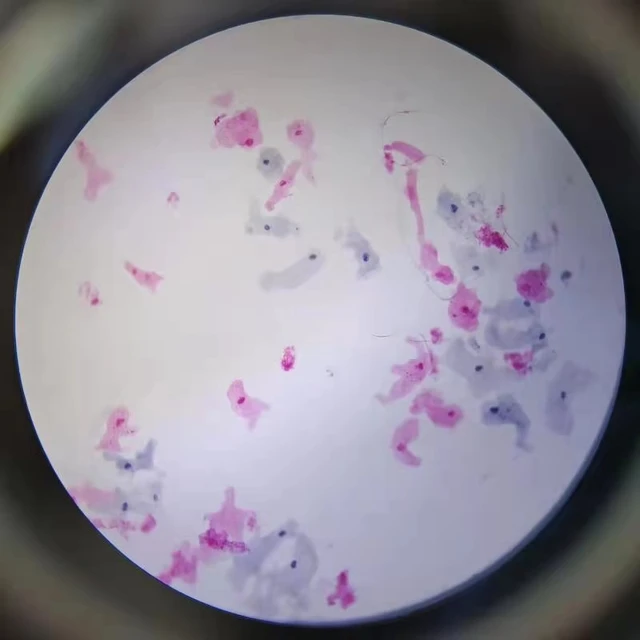 Amoeba Prepared Slide