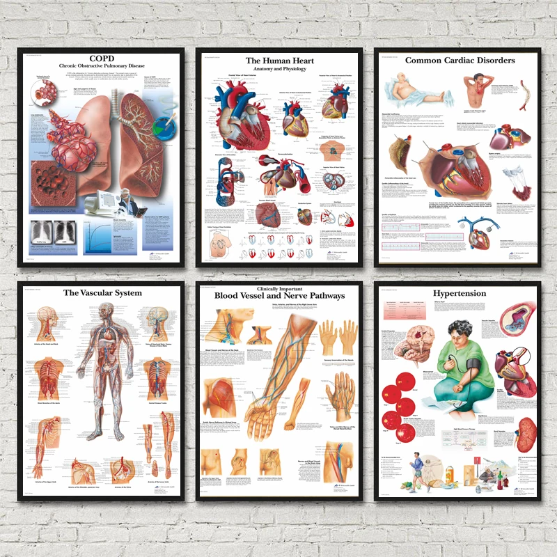 Pathology-Chart-Anatomy-Diseases-Posters-And-Prints-Canvas-Art-Painting ...