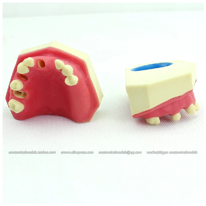 12611 / Implantation Drilling Practice Training Upper Jaw Model ...