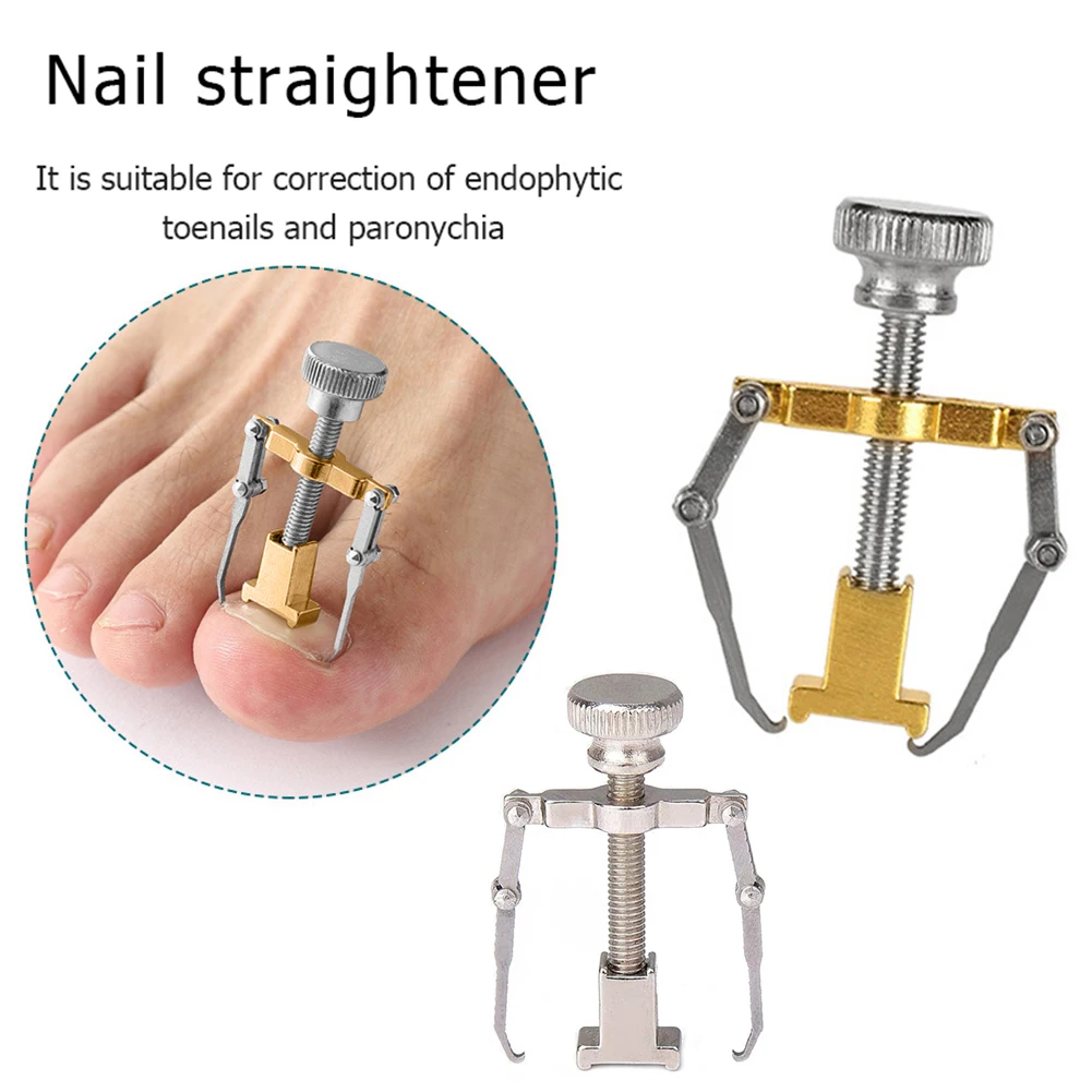 Ingrown-Toenail-Fixer-Nail-Corrector-Ingrown-Foot-Toe-Corrector-Toenail ...