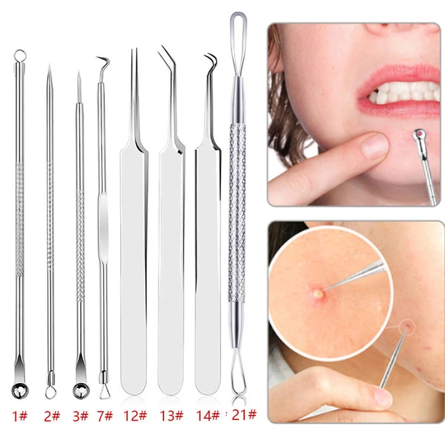 Blackhead Removal Tool Name