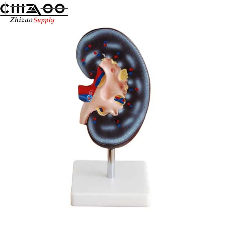 Modelo anatômico plástico médico humano do rim|Ciência médica| - AliExpress