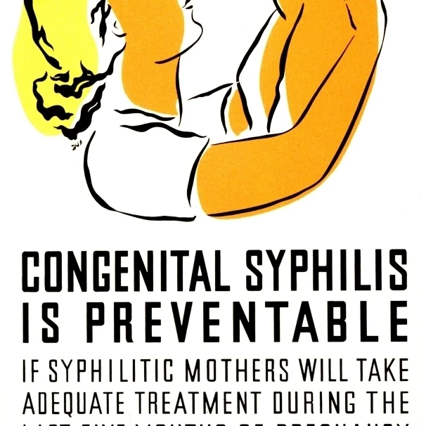 Syphilis treatment poster 1939|Placas e avisos| - AliExpress