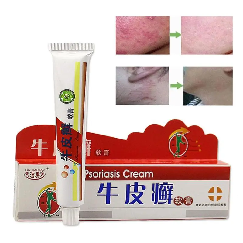 Chinese Ointment Works Perfect for Skin Problems Psoriasis Eczema Cream ...