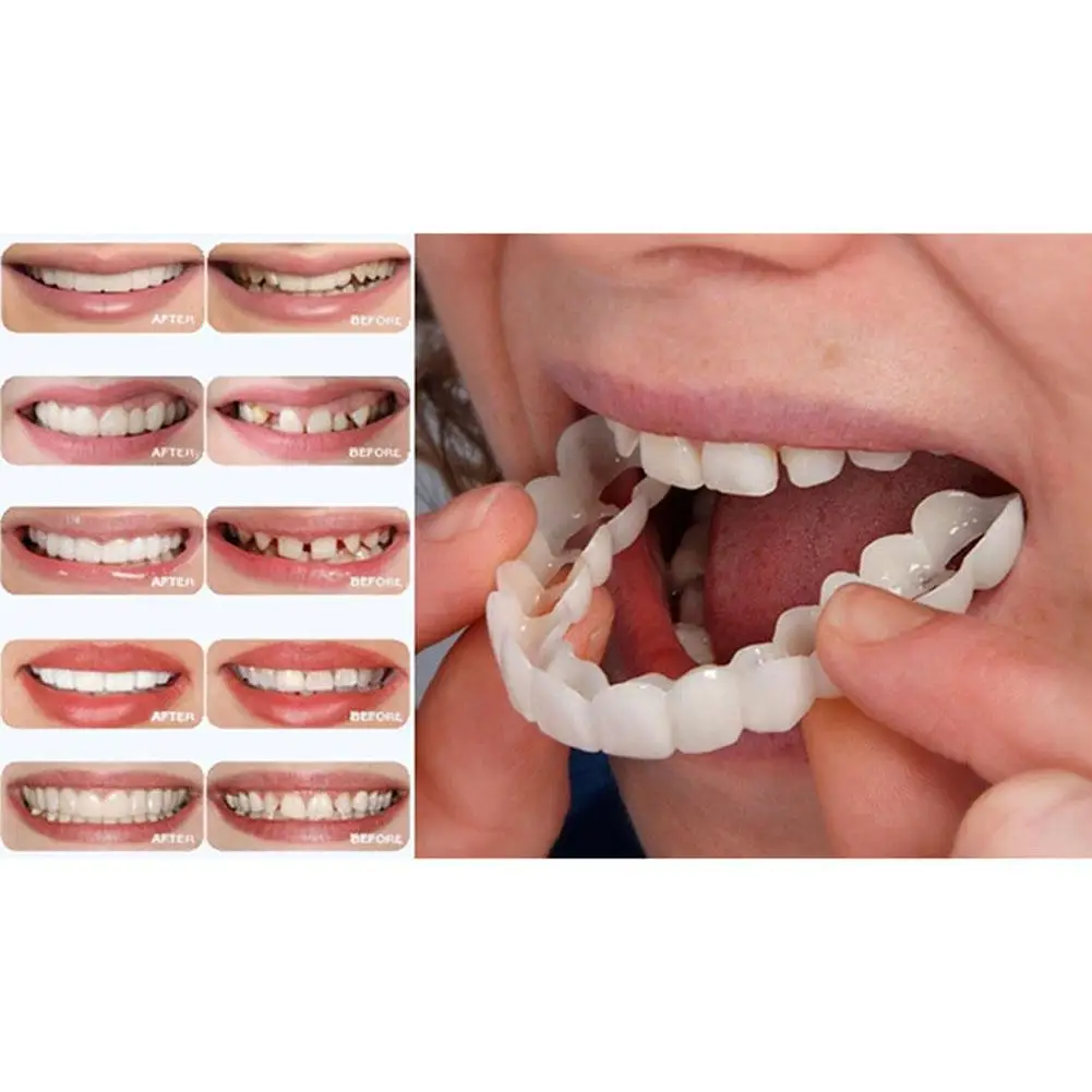 Perfect Smile Snap On Braces - Není prodáván v obchodech