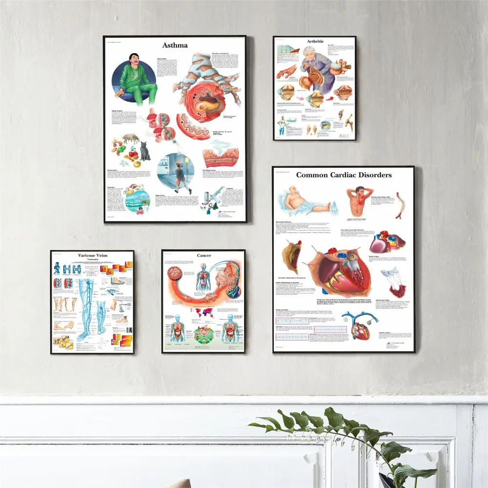Anatomy Diseases Pathology Chart Posters And Prints Canvas Art Painting ...