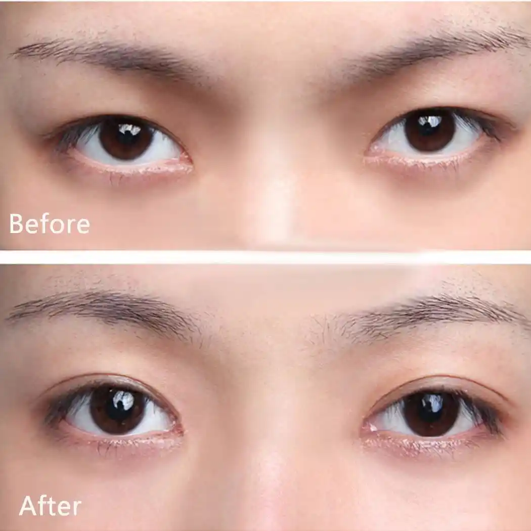 Super Stealth beige non reflective single eyelid saver double eyelid ...