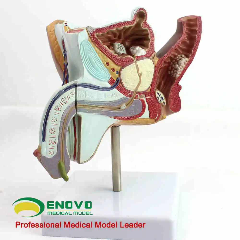 Human gonoproliferative model gynecological model gonorrhea prostate ...