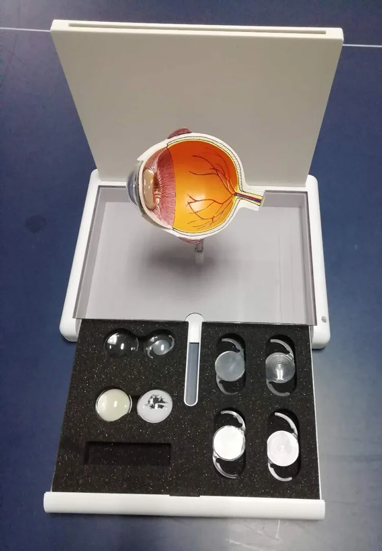 Cataract-eyeball-model-eye-anatomy-teaching-aid-medical-teaching ...
