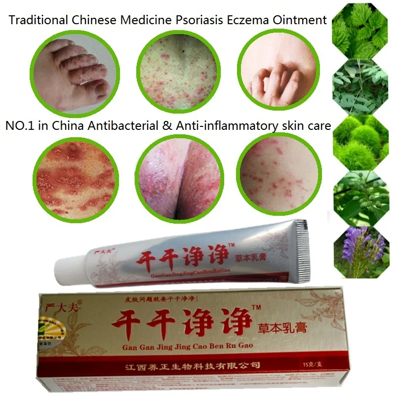 NO.1 in China traditional Chinese medicine psoriasis eczema ointment ...