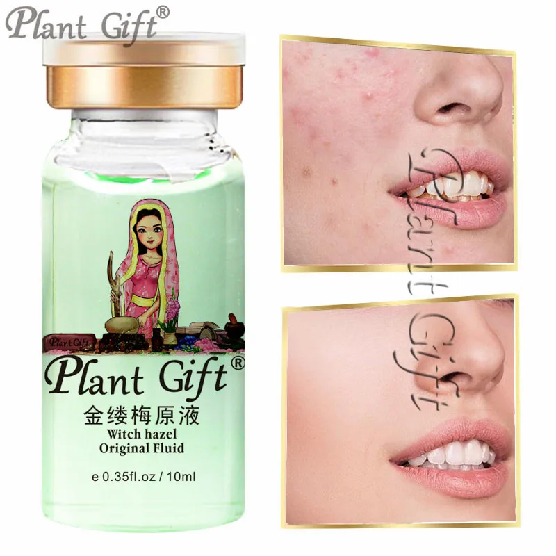 Hot Sale Witch Hazel Original Liquid Serum Shrink Pores Acne Treatment Pimples Pore Strips