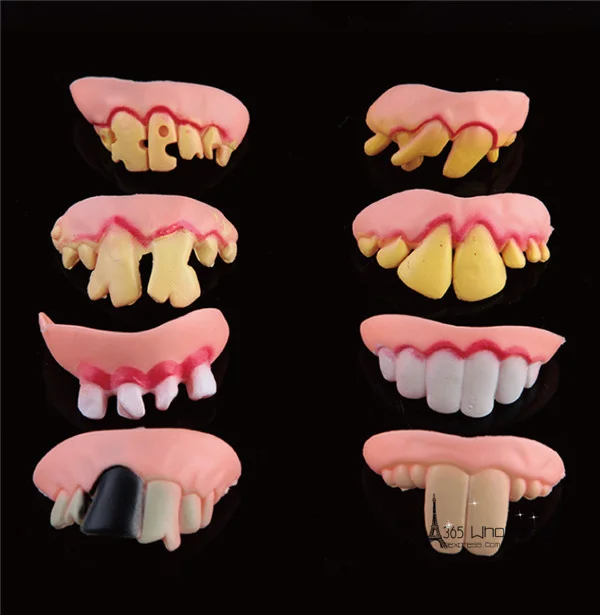 Ugly Teeth Jokes