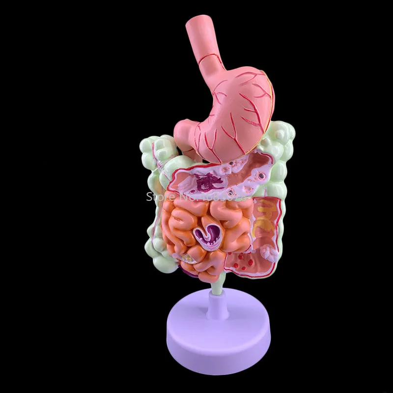 Human Digestive System Stomach Anatomy Model The Large Intestine Cecum ...