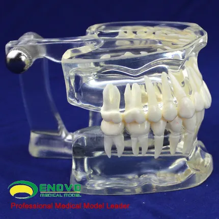 Transparent Adult Standard Dental Model Oral Dentistry Standard ...