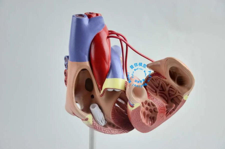 Free shipping&heart bypass model, Human heart model ,Coronary heart ...