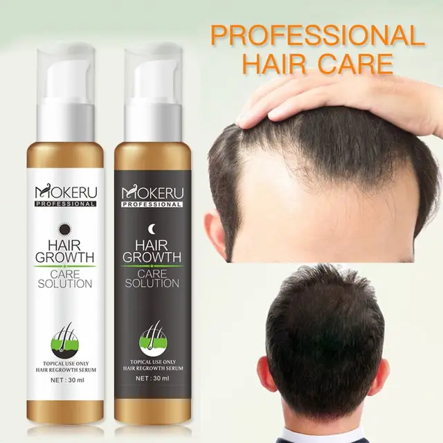 Mokeru Natural Organic Fast Hair Regrowth Treatment Spray Serum Anti