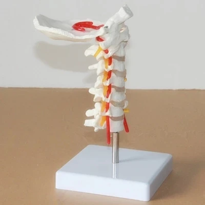 Cervical-vertebra-model-Cervical-spine-with-neck-artery-occipital-bone ...