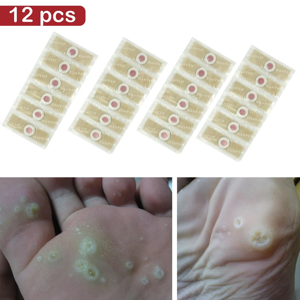 12PCS Medical Plaster Foot Corn Removal Warts Thorn patches Corn of ...