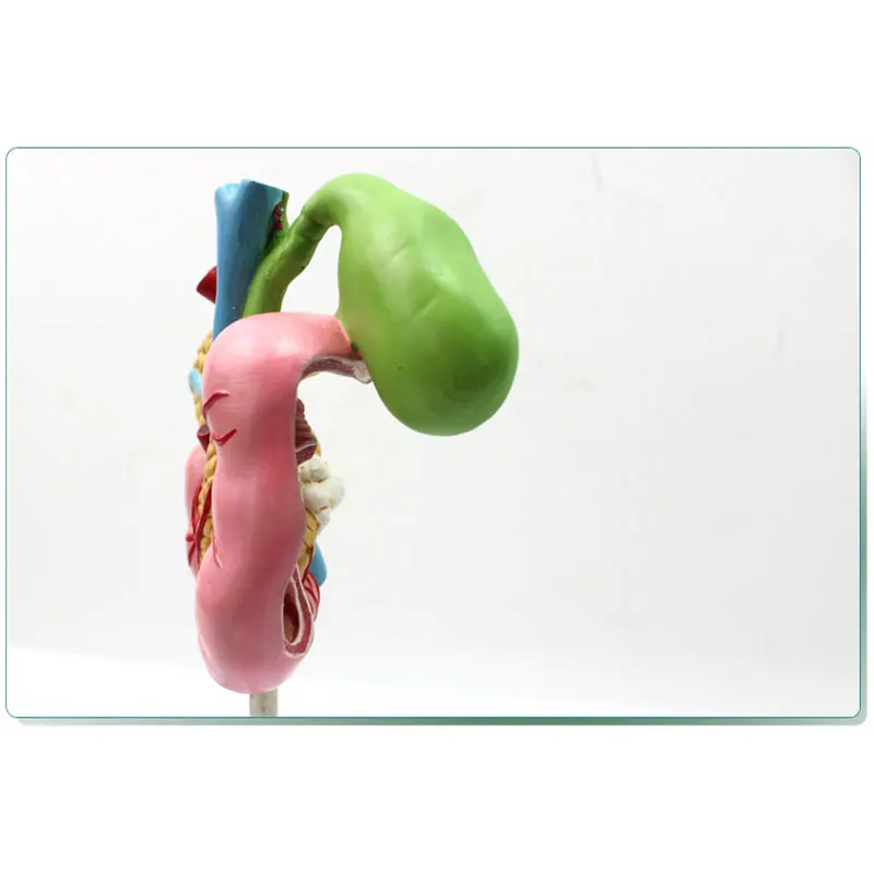 Medical Pancreatic Duodenal Gallbladder Pathological Model Gallstone ...