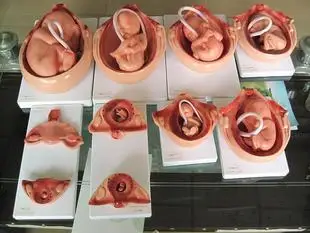 human body Model 10 set Development process for fetus embryo pregnancy ...