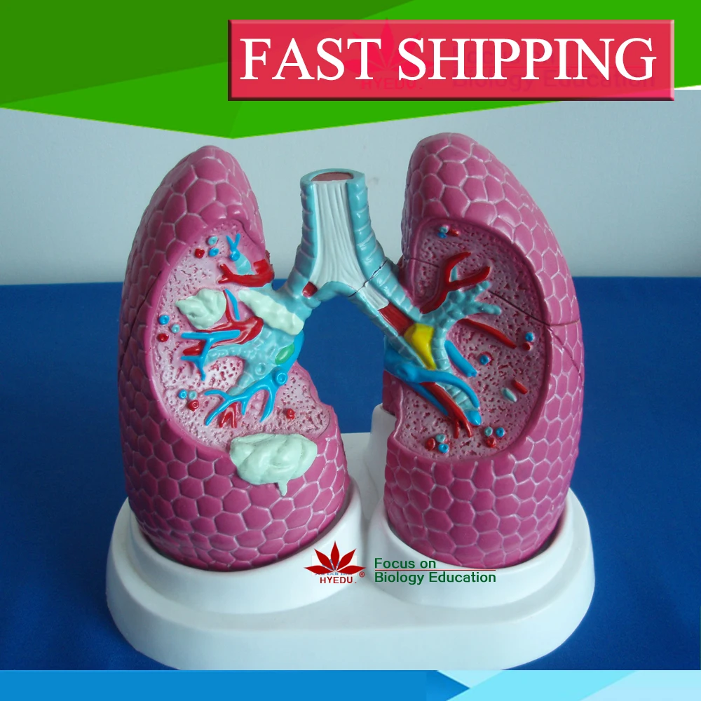Anatomy education Bronchopulmonary pathology Lung cancer model|lungs ...