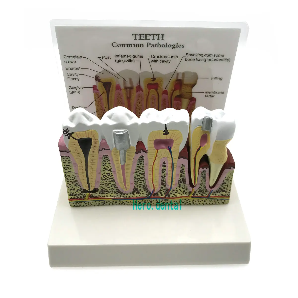 Dental Tooth Teeth Anatomical Model Dental Anatomy Teeth Model ...