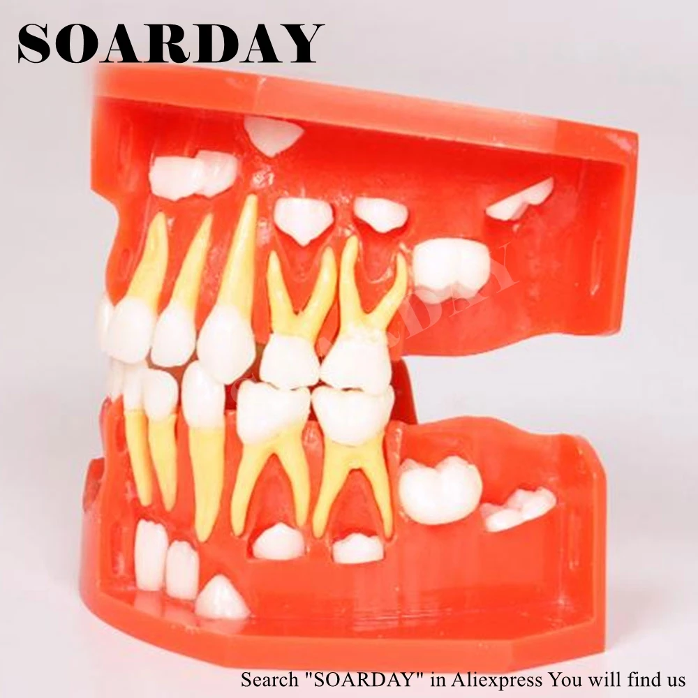 SOARDAY Primary Teeth Alternative Model for 3 6 years old Child showing ...
