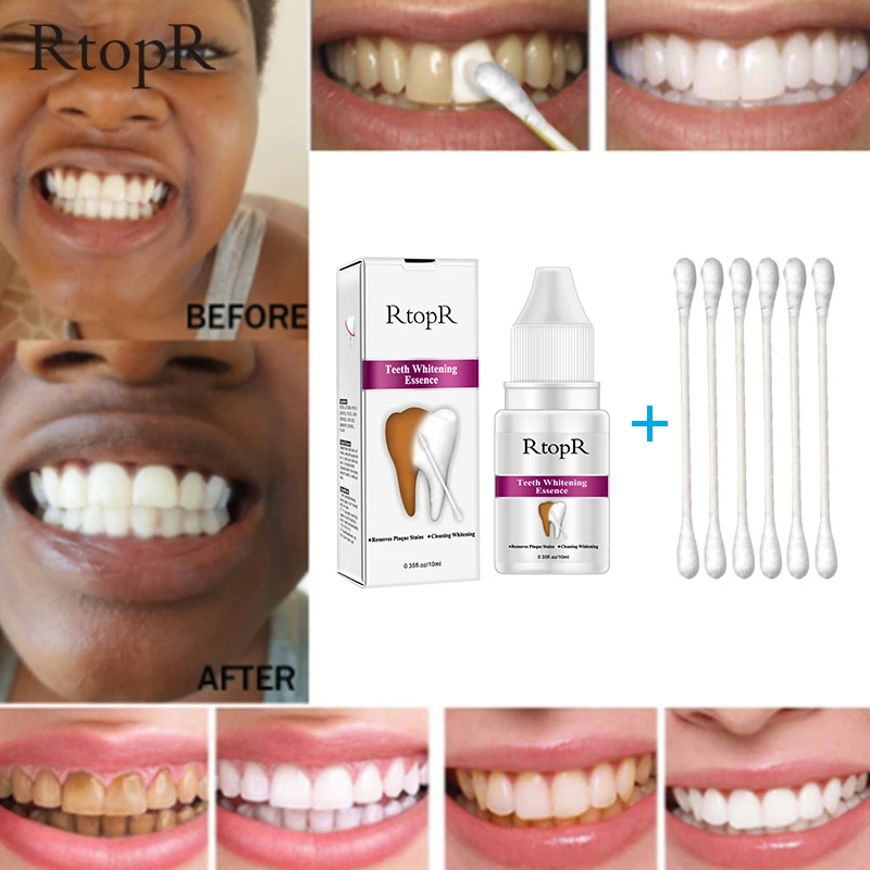 RtopR Teeth Whitening Essence Powder Oral Hygiene Cleaning Serum ...