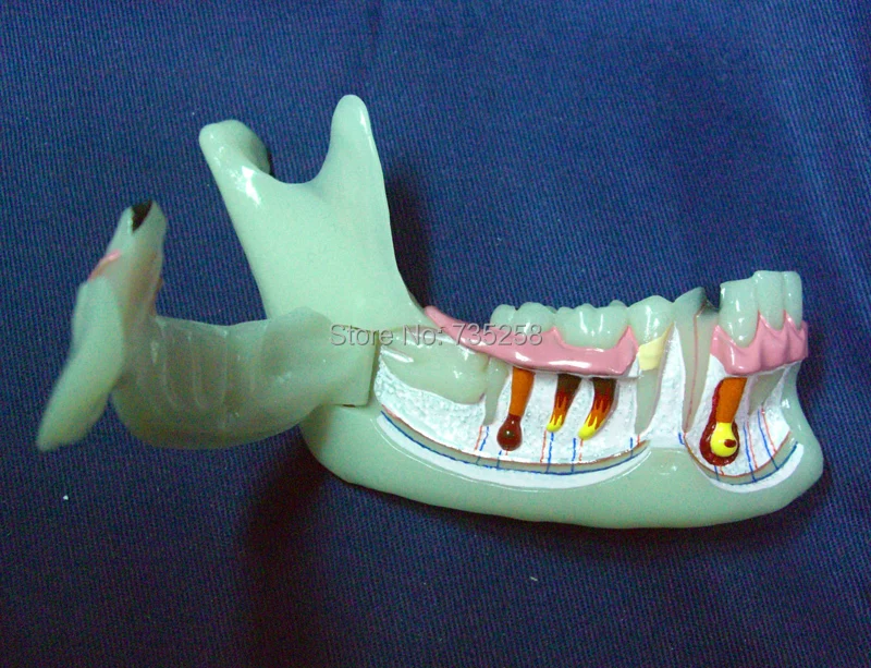 Advanced-Simulation-Model-of-Mandibular-Tissue-Decomposition-Simulation ...