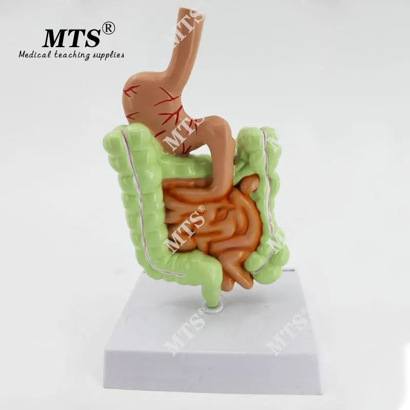 Human Gastrointestinal Pathology Anatomy Model Digestive Tract Gastric ...
