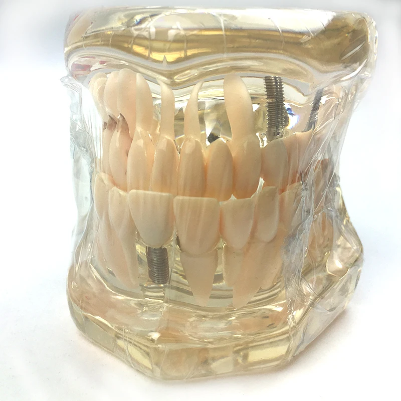 1: 1 Teeth Model Dental lab denture tooth anatomy Transparent resin ...