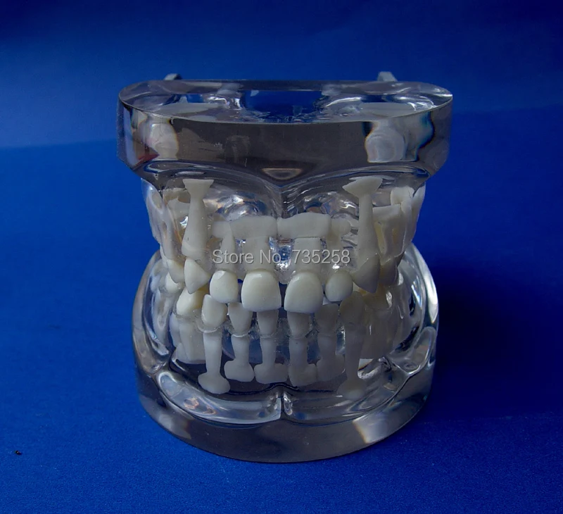 5-to-9-Years-Old-Tooth-Development-Model-Baby-Teeth-Model-Permanent ...