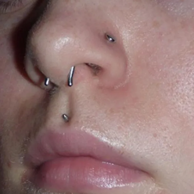 Vertical Labret Retainer