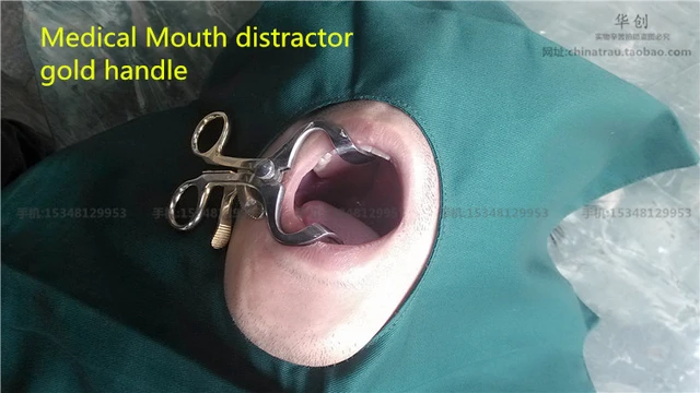 Medical Mouth distractor stainless steel Mouth gag oral cavity dental ...