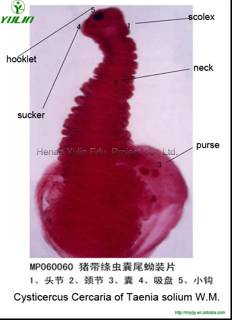 Taenia Pisiformis Cysticercus Slide Description And Life Cycle Of
