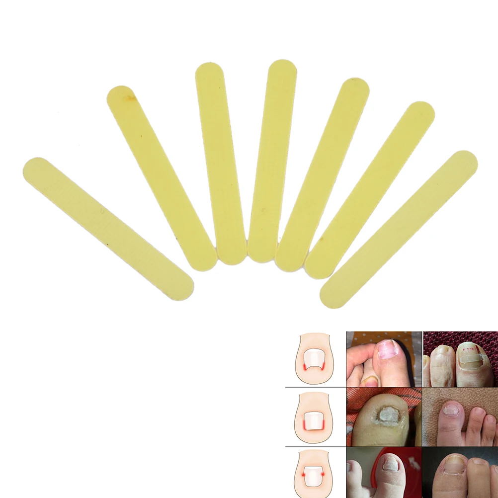 Вросший носок коррекция ногтей Наклейка патч для коррекции пароникции ...