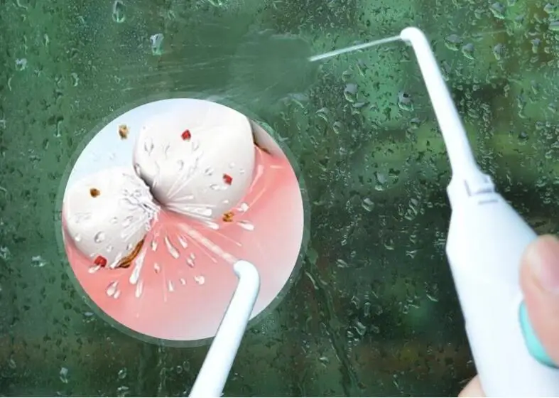 DIY oral dental irrigator tooth cleaner for cleaning teeth hand press ...