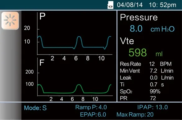 BMC BiPAP GII Bi-Level CPAP Machine With Humidifier – GeekyViews