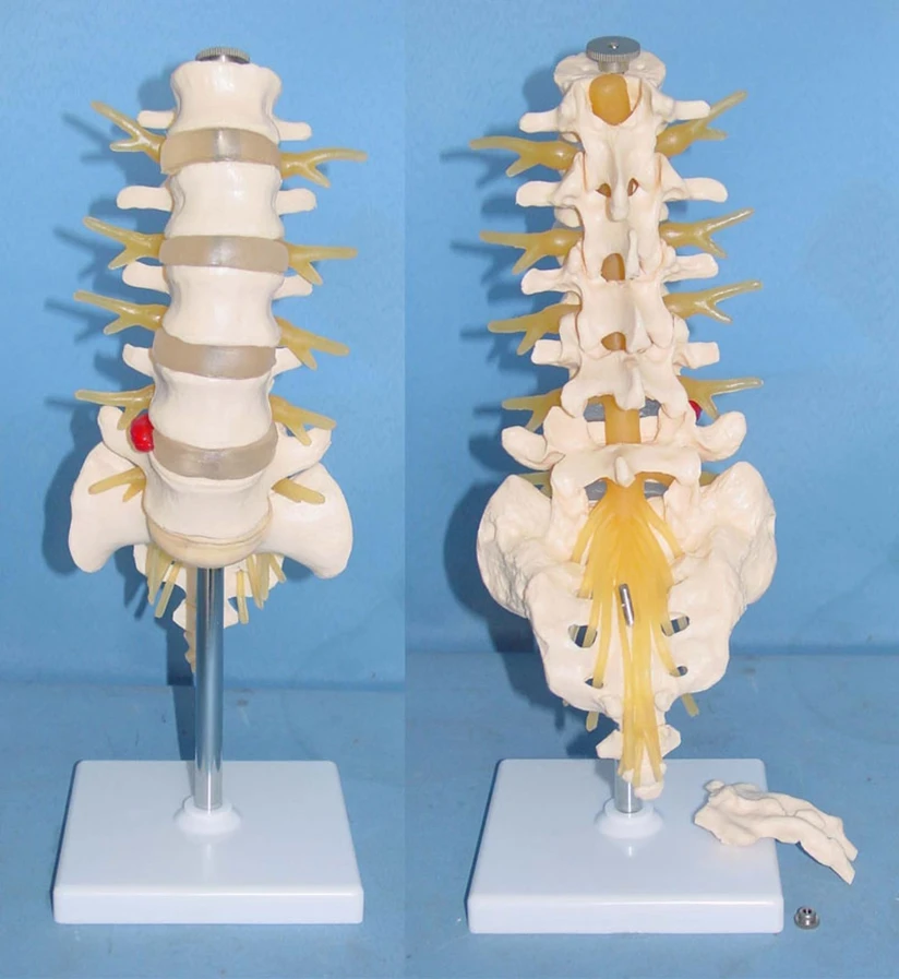 1:1 Lumbar Cauda equina nerve model free shipping-in Medical Science ...
