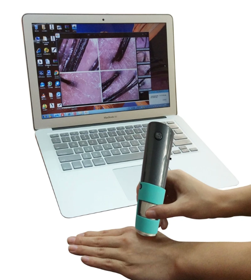 M30F-2MP-600X-HD-Portable-Wifi-Digital-Microscope-Skin-Analyzer-Image ...