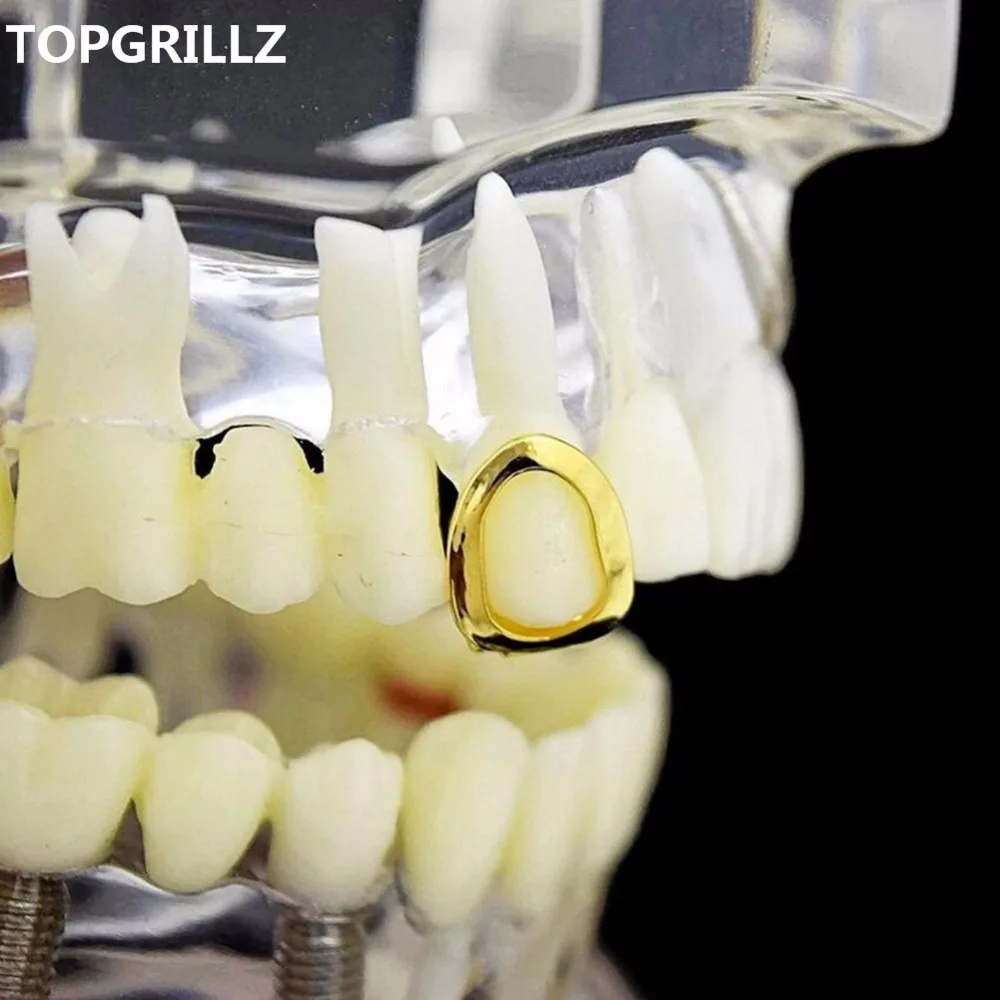 White Gold Teeth Caps