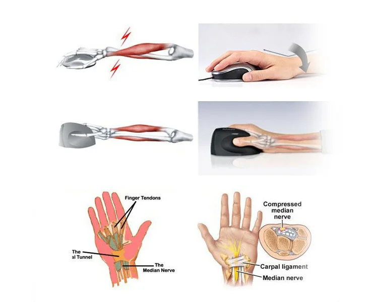 Mouse In Ergonomic Design Vertical Optical Mouse JOY Wrist Pain For ...