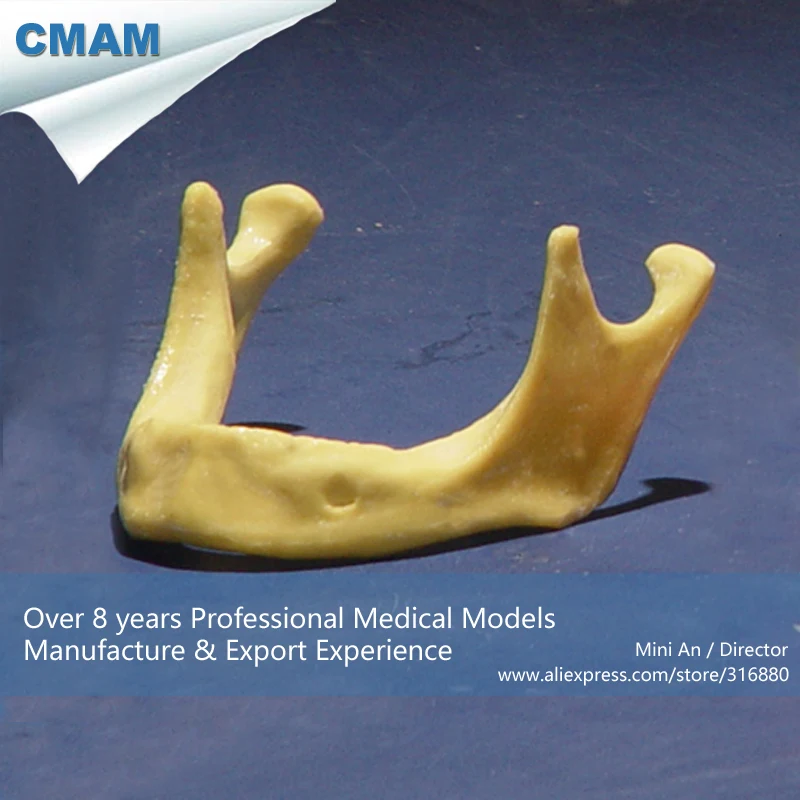 12613 / Toothless Mandible Jaw Model Implant Practice Training, Medical ...