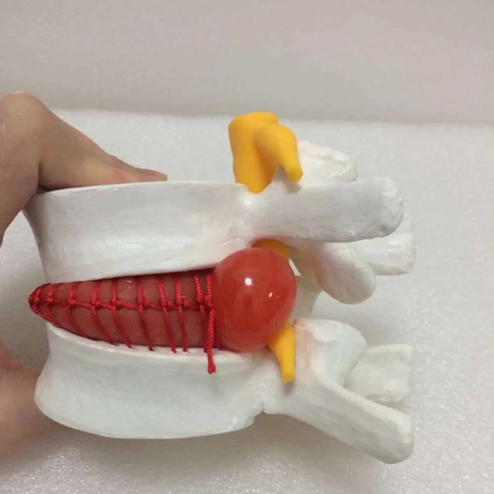 Medical Human Lumbar Disc Demonstration Model Lumbar Spine Model Spine ...