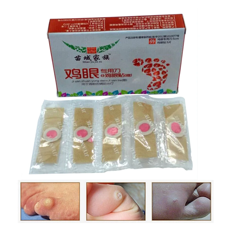 25 foot care medical plaster foot clavus removal calluses plantar warts ...