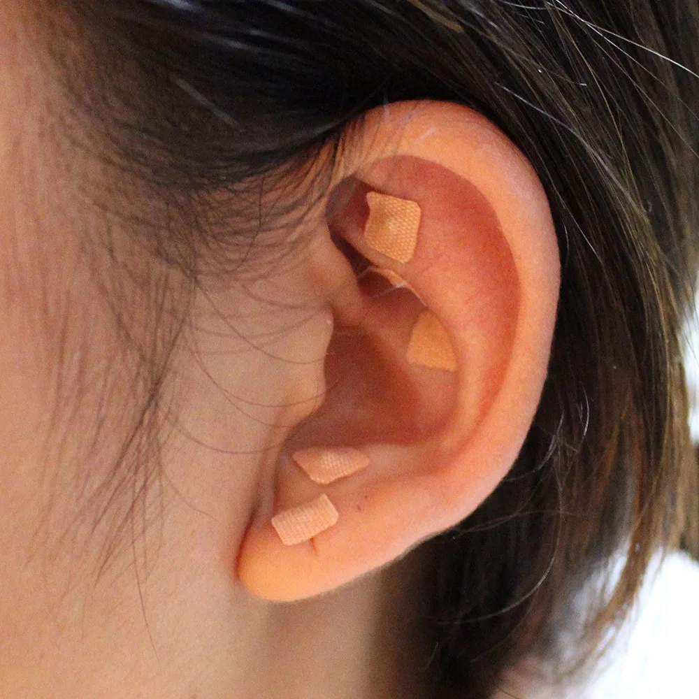 Auriculotherapy Ear Weight Loss Seed Kit 600 Vaccaria Ear Seeds