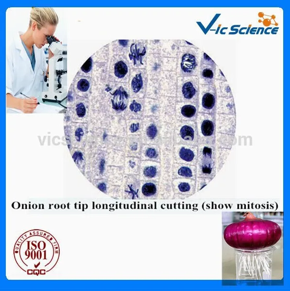 5pcs Microscope Mitosis Prepared Slides Set For Onion Root Tip ...