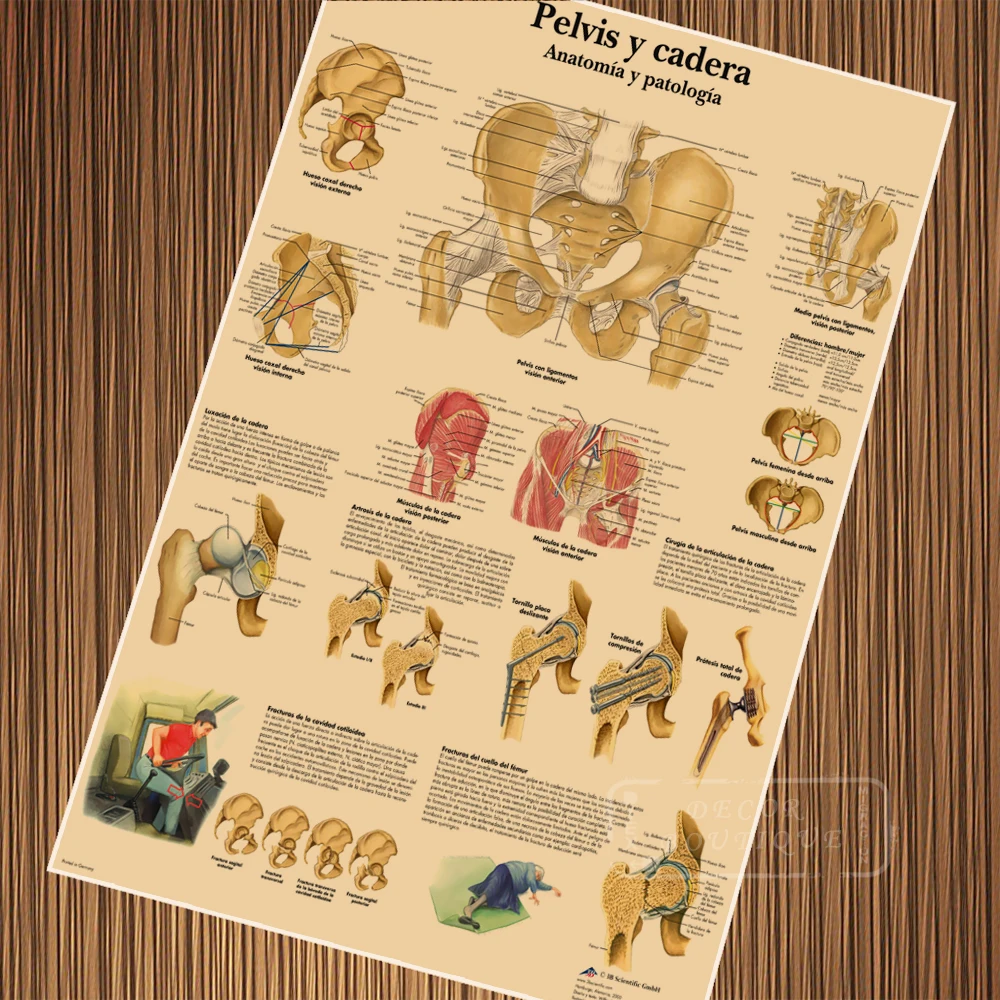 P-ster-de-mapa-de-cadera-de-rodilla-y-Pelvis-de-anatom-a-humana ...